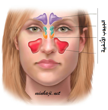 ثالثاً: الوقاية من الرعاف - منهاجي